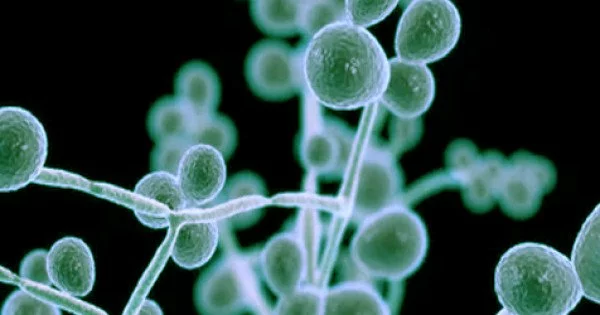 Candidoses vaginales : Causes, Diagnostic, Traitement et Prévention